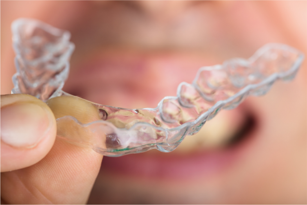 Le bruxisme - Tourisme dentaire